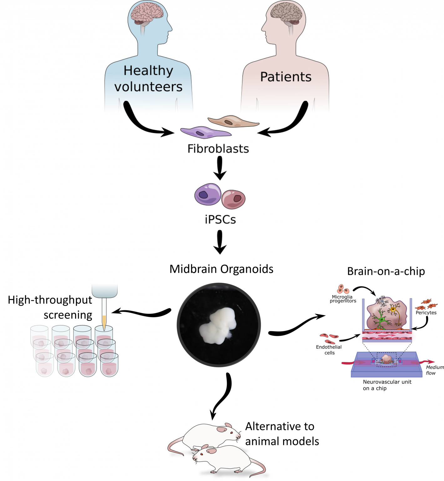 Brain organoid - Lehtonen lab/ Human Brain Disease Modelling Research Group