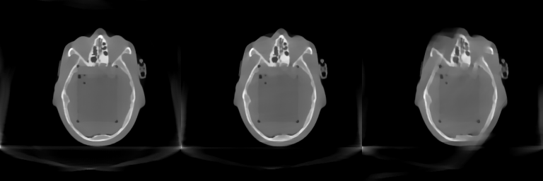 Multimodality medical imaging - Inverse Problems Research Group