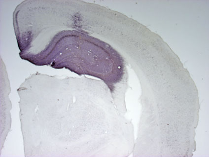 3. Stereotactic injections - Phenotyping Center